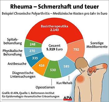Biotech-Protein stoppt erstmals Rheuma - Mensch - derStandard.at ...