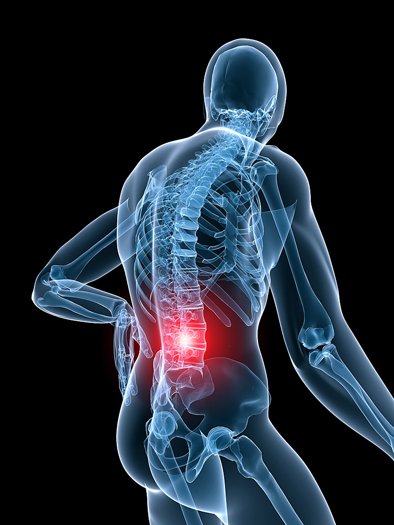 Rheuma nimmt hunderte Formen an - Rheuma - derStandard.at › Gesundheit