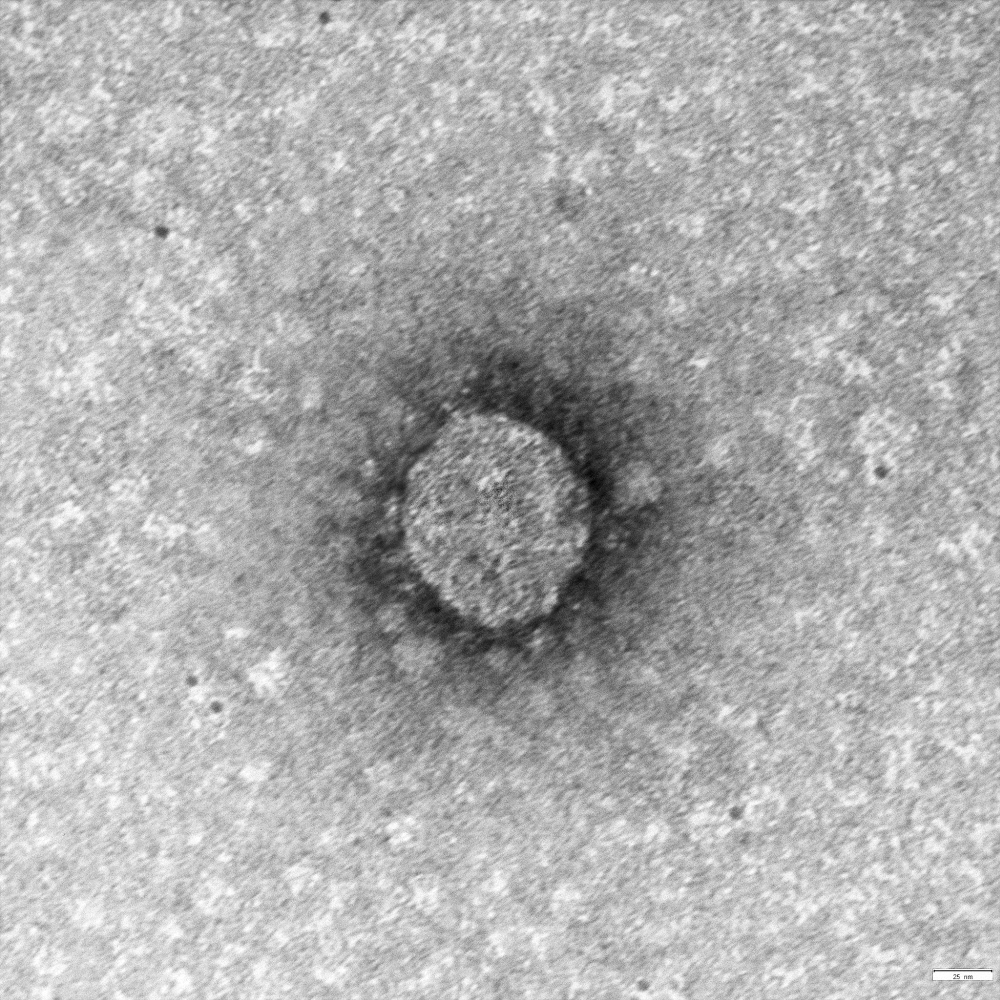 Erste Bilder von Coronaviren aus Österreich veröffentlicht - Mensch ...