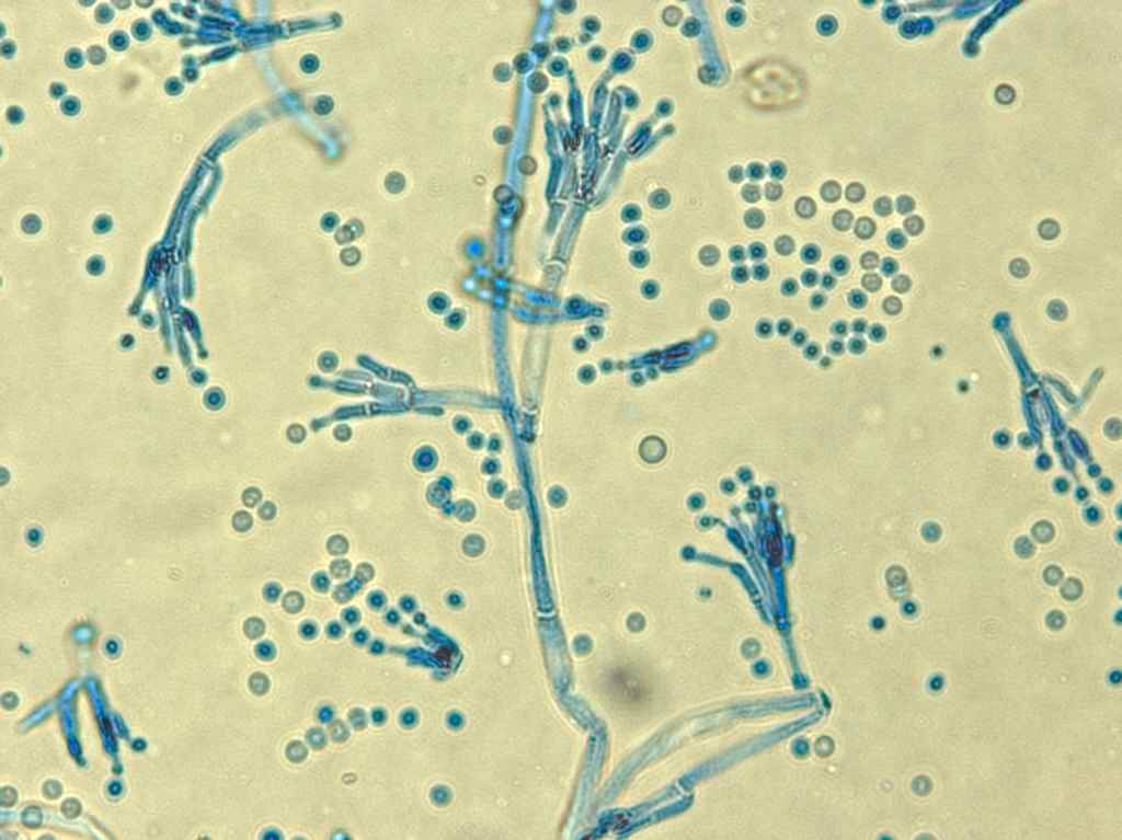 Schimmelpilze als Lebensmittelveredler: Von Roquefort, Camembert und ...